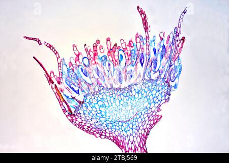 Antheridium of Mnium sp. Optical microscope X100 Stock Photo - Alamy
