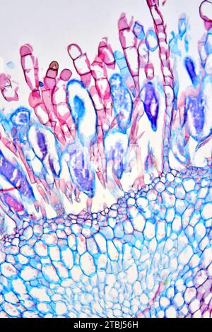 Antheridium of Mnium sp. Optical microscope X40 Stock Photo - Alamy