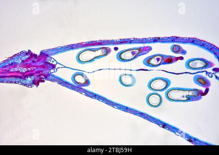 Ovary with embryos of shepherd purse (Capsella bursa-pastoris). Optical ...