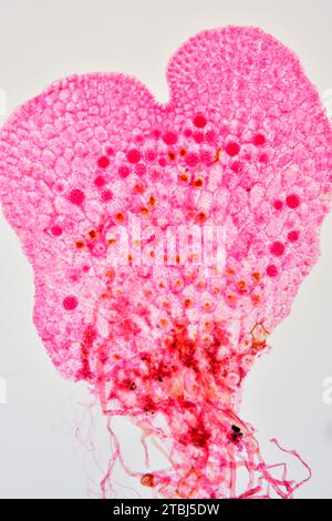 Fern prothallus or prothallium with rizoids. Optical microscope X40 ...