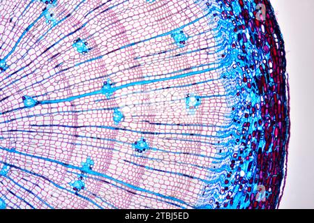 Pine (Pinus sp.) root. Optical microscope X100 Stock Photo - Alamy