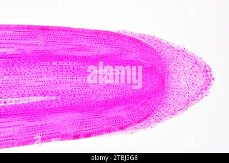 Calyptra or root cap showing statocytes responsibles of gravity ...