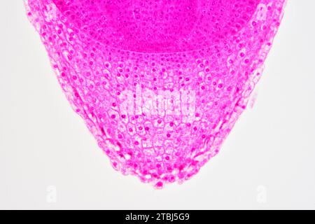 Calyptra or root cap showing statocytes responsibles of gravity ...