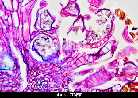 Sorus with sporangia of fern Aspidium sp. Optical microscope X100 Stock ...