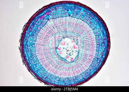 Eudicot stem (Ranunculus sp.) showing epidermis, collenchyma, cortex ...