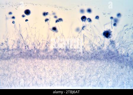 Conidia of Aspergillus, an ascomycota fungi. Optical microscope X200 ...