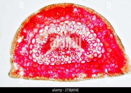 Leaf cross section of pine (Pinus sp.) showing endodermis, epidermis ...