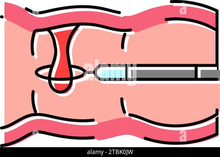 colon polyps gastroenterologist color icon vector illustration Stock ...
