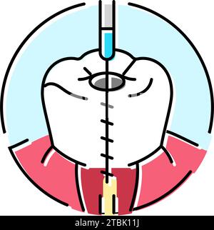 Dental Procedure - Root Canal Treatment - Stock Illustration as EPS 10 ...
