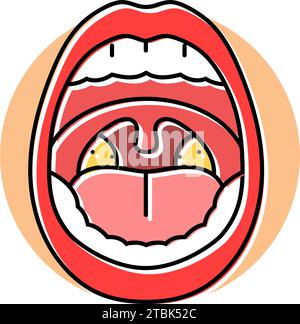 swollen tonsils disease symptom line icon vector illustration Stock ...