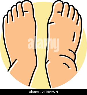 swollen ankles feet disease symptom isometric icon vector illustration ...