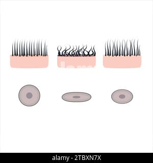 Hair types, conceptual illustration Stock Photo - Alamy