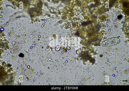 soil microbes under the microscope. microorganisms with fungus in ...