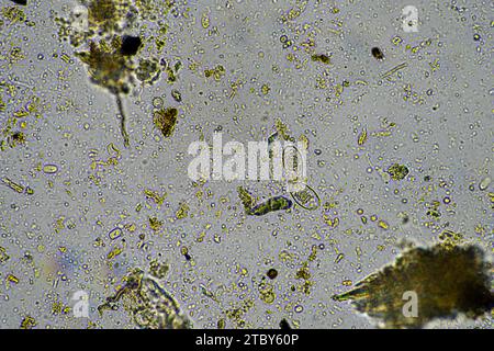 soil microbes under the microscope. microorganisms with fungus in ...