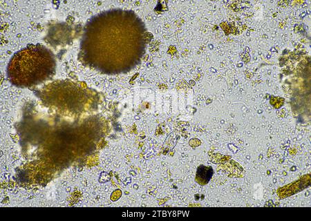 soil microbes under the microscope. microorganisms with fungus in ...