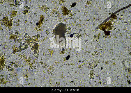soil microbes under the microscope. microorganisms with fungus in ...