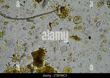 soil microbes under the microscope. microorganisms with fungus in ...