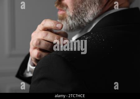 Bearded man brushing dandruff off his jacket on grey background ...