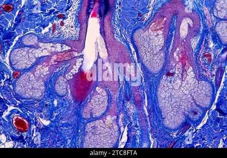 Human skin showing hairs, sebaceous glands and connective tissue. Cross ...