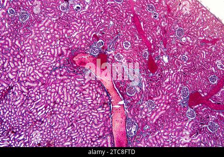 Human kidney cortex section showing Bowman capsules, glomerulus ...