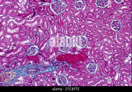 Human kidney cortex section showing Bowman capsules, glomerulus ...