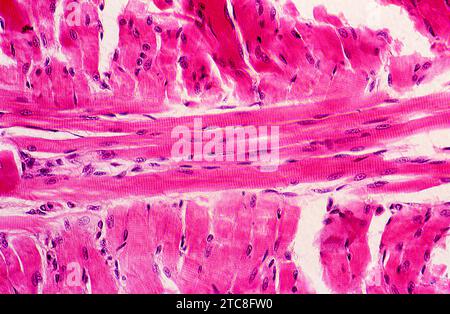 Striated muscle tissue longitudinal section. Optical microscope ...