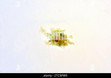 Amoeba proteus is a protozoan that uses his pseudopodia to phagocytize ...