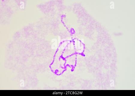 Giant or polytene chromosomes of Chironomus salivary glands. Optical ...
