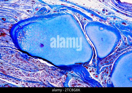 Connective tissue, transition of cartilage to bone in human fetus ...