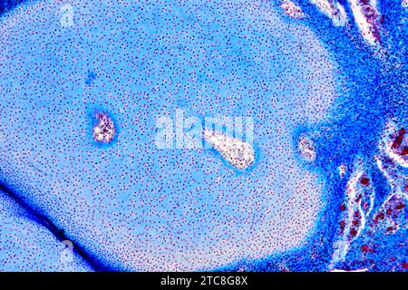 Connective tissue, transition of cartilage to bone in human fetus ...