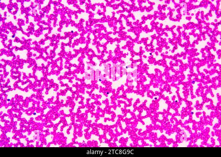 Mammal blood showing erythrocytes and leukocytes. Light microscope X600 ...