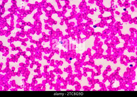Mammal blood showing erythrocytes and leukocytes. Light microscope X600 ...