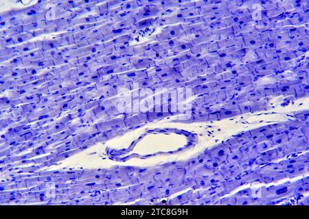 Cardiac muscle showing myocytes. Light microscope X150 at 10 cm wide ...
