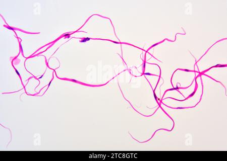 Smooth muscle (myocytes). Light microscope X300 at 10 cm wide Stock ...