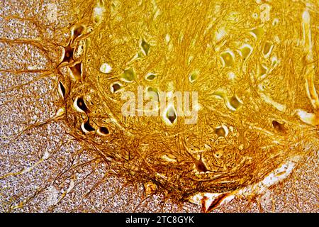 Spinal cord cross section showing neurones and glia cells. Light ...