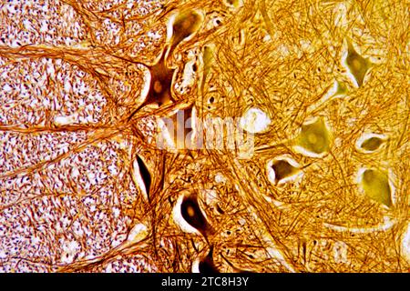 Spinal cord cross section showing neurones and glia cells. Light ...