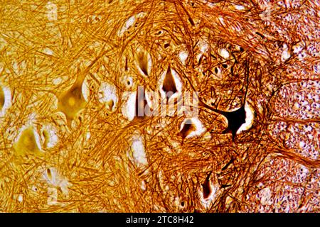 Spinal cord cross section showing neurones and glia cells. Light ...