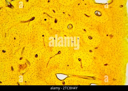 Cortical bone tissue showing Haversian canals, osteons, osteocytes and ...