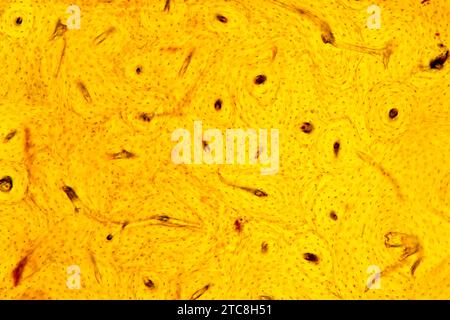 Cortical bone tissue showing Haversian canals, osteons, osteocytes and ...
