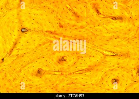 Cortical bone tissue showing Haversian canals, osteons, osteocytes and ...