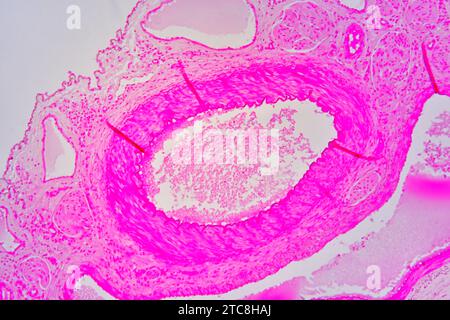 Venule (blood vessel). Light microscope X150 at 10 cm wide Stock Photo ...