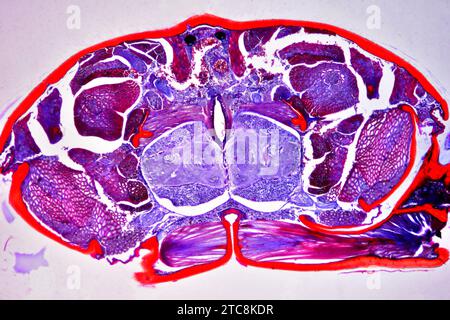 Garden spider (Araneus sp.) cephalothorax cross section showing chitin ...