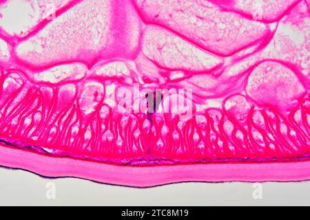 Ascaris lumbricoides female showing cuticle, epithelium, longitudinal ...