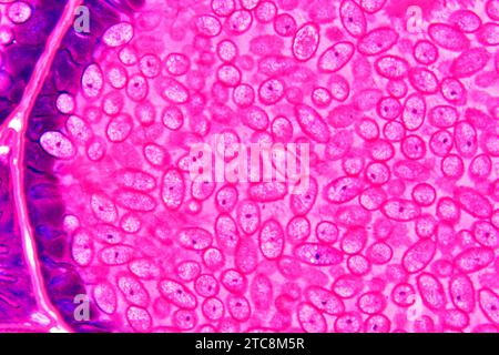 Ascaris, cross-section, light micrograph, pictured area is ...