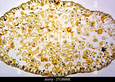 Ascaris, cross-section, light micrograph, pictured area is ...