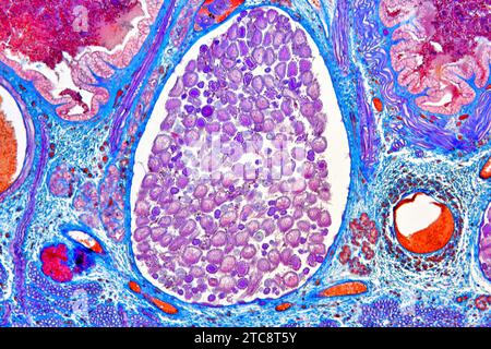 Leech, light micrograph Stock Photo - Alamy