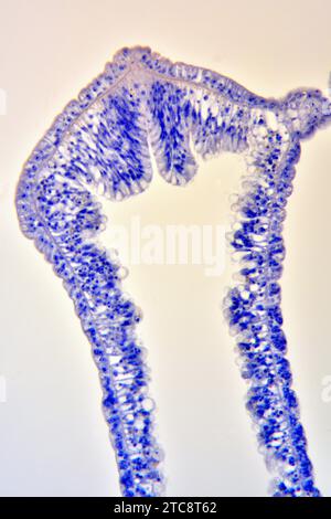 Hydra, light micrograph Stock Photo - Alamy