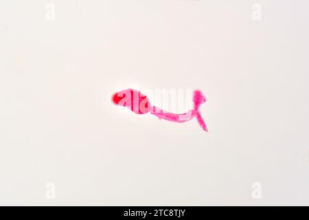 Schistosoma mansoni cercaria larva. Light microscope X300 at 10 cm wide ...