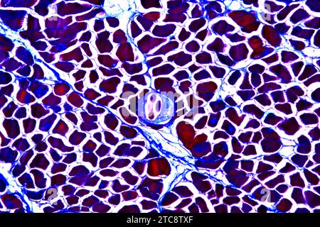 Pork worm larvae (Trichinella spiralis) in a muscular tissue. Light ...