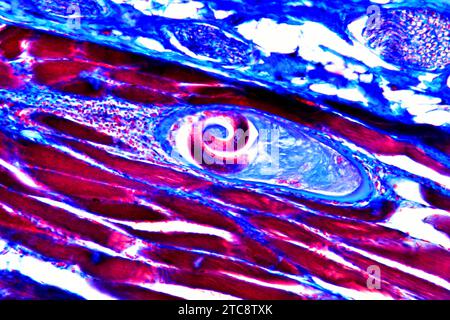 Pork worm larvae (Trichinella spiralis) in a muscular tissue. Light ...
